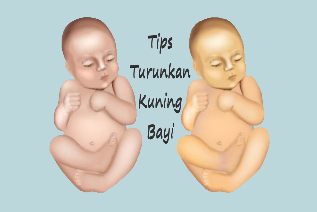 5 Tips Turunkan Kuning Bayi yang Berkesan dan Wajib Dicuba